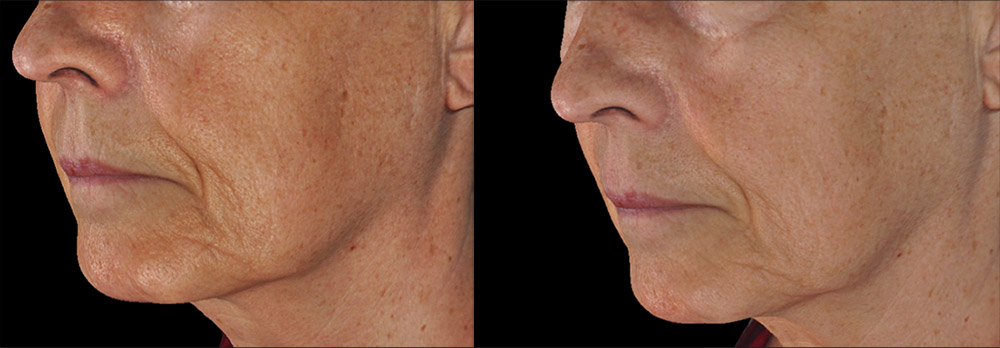 GREDECO Dermatology and cosmetology: clinical Evaluations.