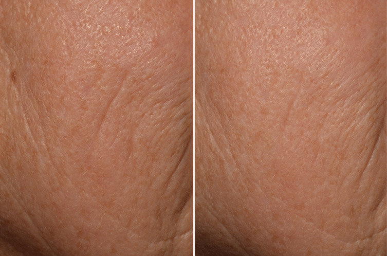 GREDECO Dermatology and cosmetology: clinical Evaluations.