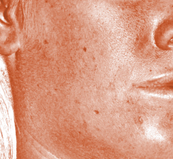 GREDECO Dermatology and cosmetology: clinical Evaluations.