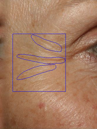 GREDECO Dermatology and cosmetology: clinical Evaluations.